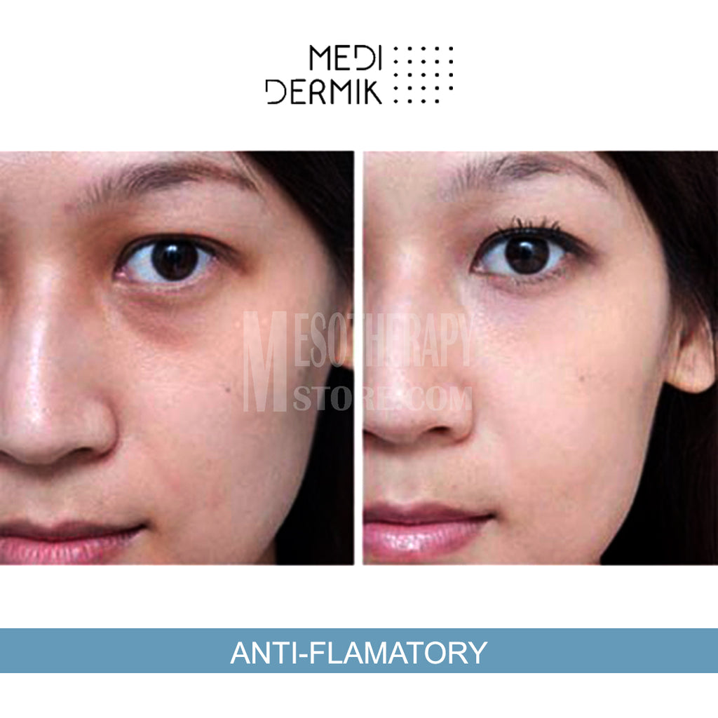 Hyaluronidase By Medidermik Mesotherapy - Mesoterapia